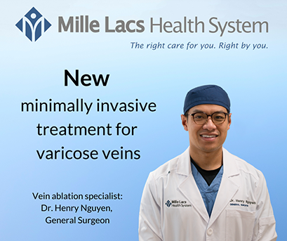 New minimally invasive treatment for varicose veins - Mille Lacs Health System